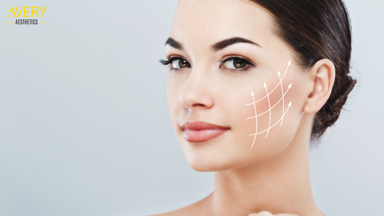 Cheek Enhancement | Avery Aesthetics Kent